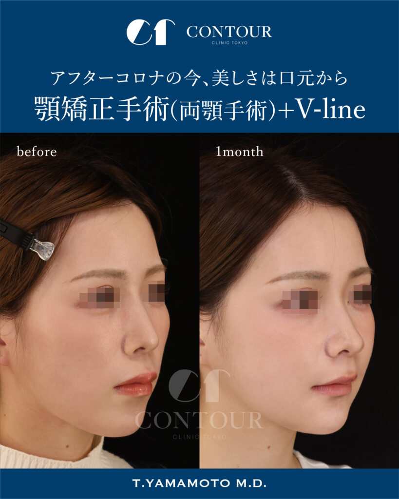 症例写真 | コントアクリニック東京